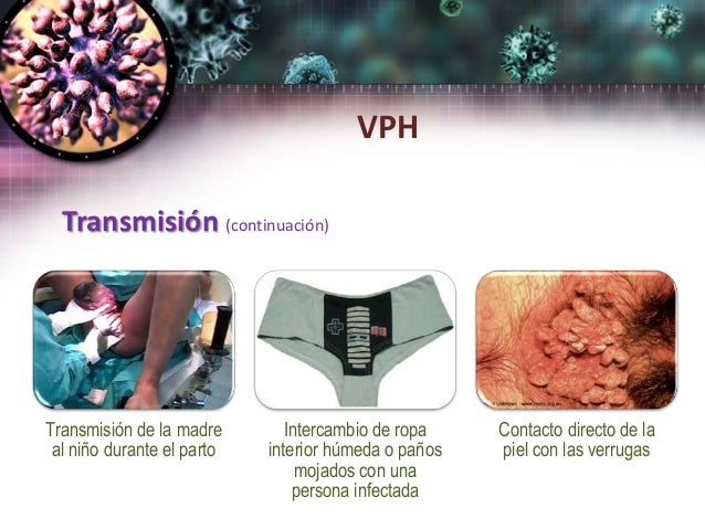 Vph