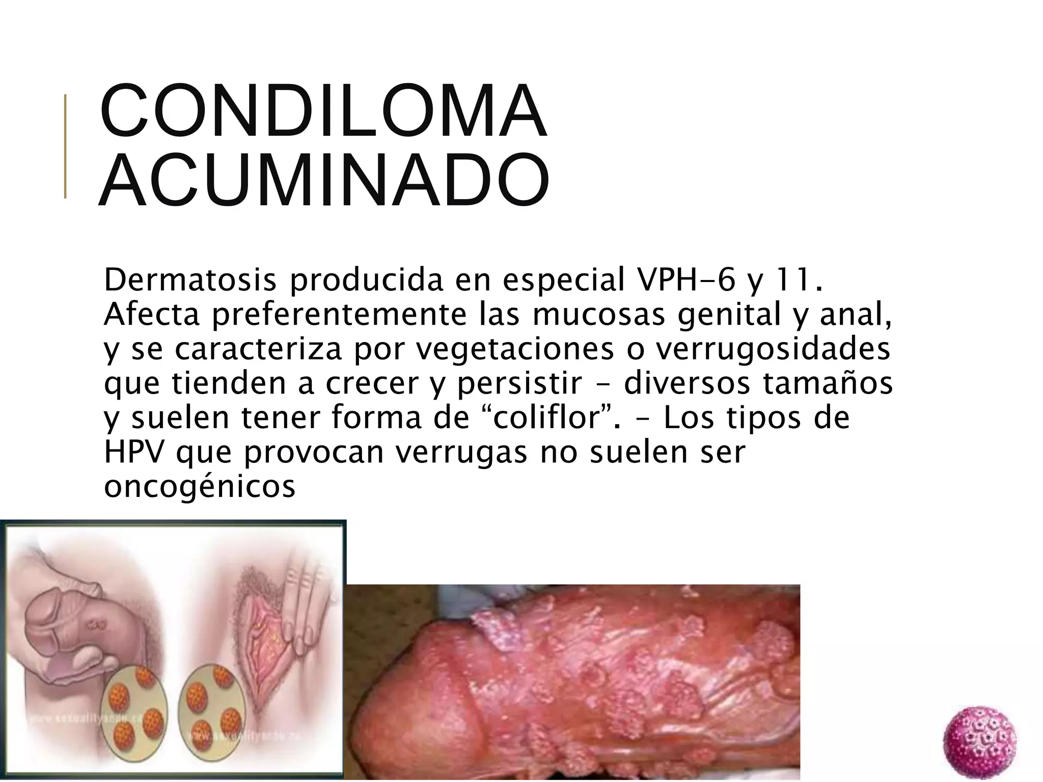 virus del papiloma humano | PPTX