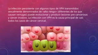 virus papiloma humano, definición y tratamiento | PPTX