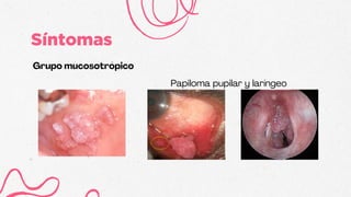 virus del papiloma humano presentacion academica | PDF
