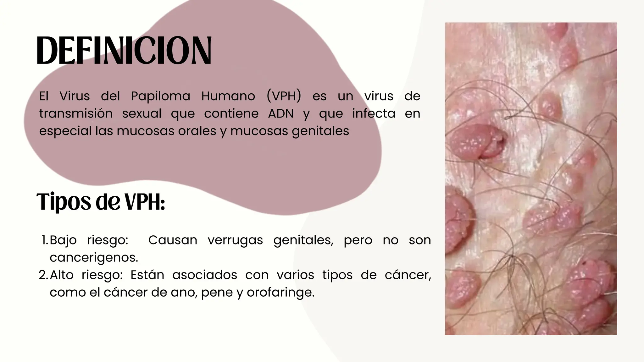 Virus del papiloma humano en hombres.pdf