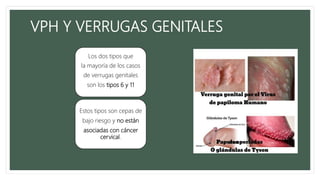 Vph ginecologia | PPTX