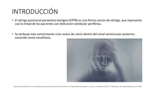 VÉRTIGO POSTURAL PAROXÍSTICO BENIGNO | PPTX