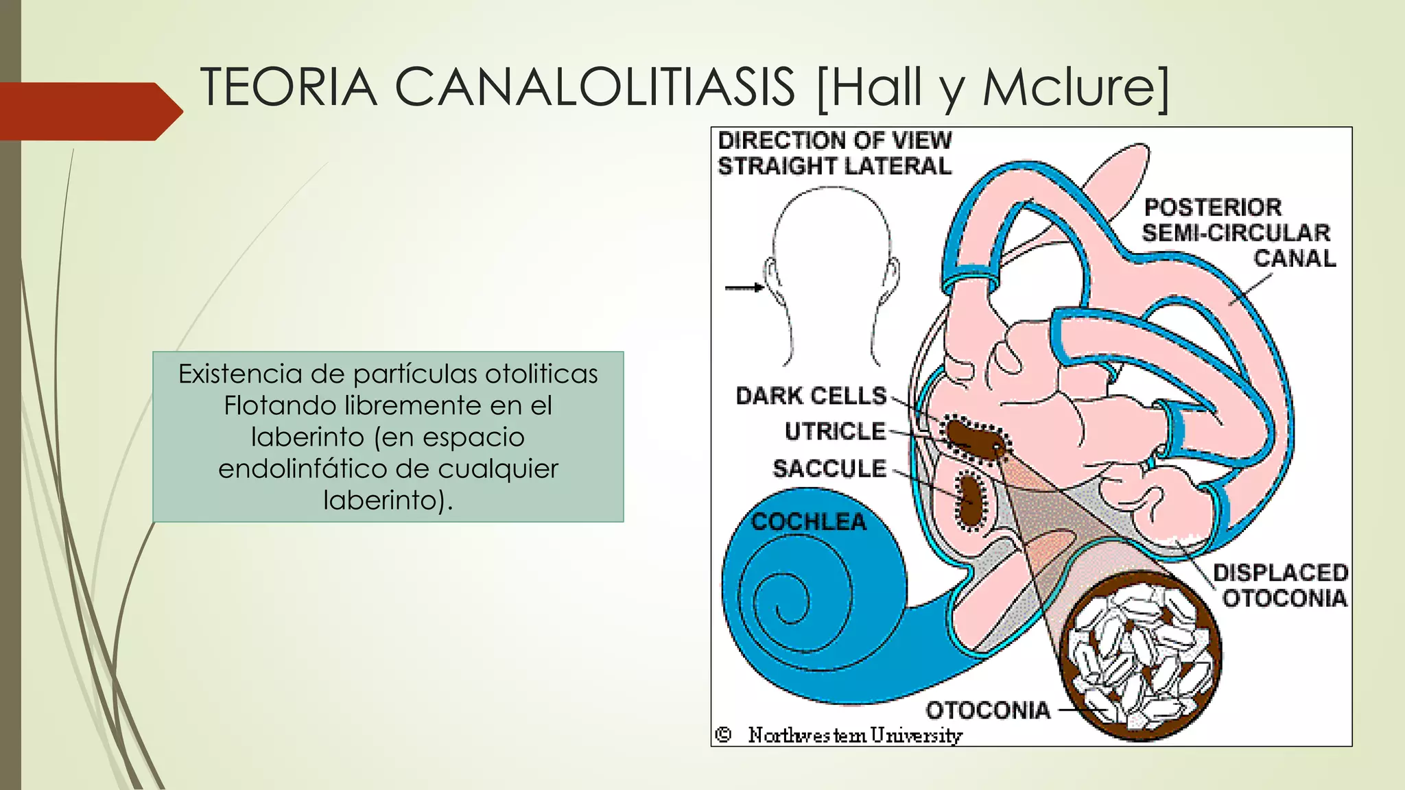 Vertigo Posicional Paroxistico Benigno | PPTX | Ear, Nose and Throat ...