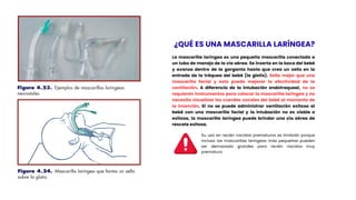 VPP E INTUBACIÓN EN BASE A LA GUIA DE RCP NEONATAL 8VA EDICION. | PDF