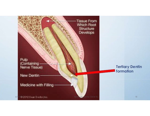Management of incomplete root apex for vital tooth