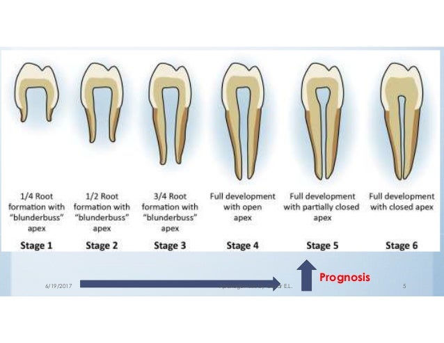 Management of incomplete root apex for vital tooth