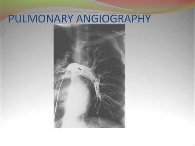 VQ scan of lung | PPT
