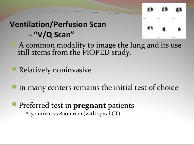 VQ scan of lung