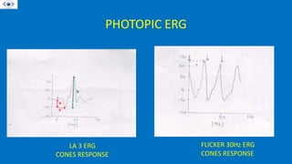ERGVEP presentation dhir hospital bhiwani.pptx