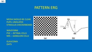 ERGVEP presentation dhir hospital bhiwani.pptx