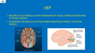 ERGVEP presentation dhir hospital bhiwani.pptx