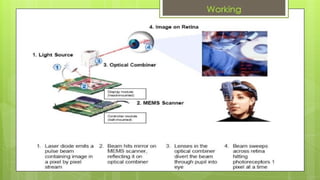Virtual Retinal Display | PDF | Cameras and Camcorders | Consumer ...