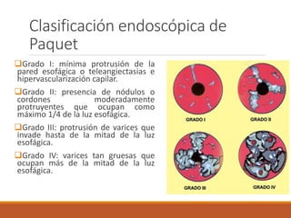 Várices esofágicas | PPTX
