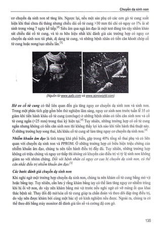 CHUYỂN DẠ SINH NON | PDF