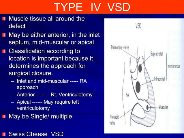 Vsd | PPTX | Heart and Cardiovascular Diseases | Diseases and Conditions