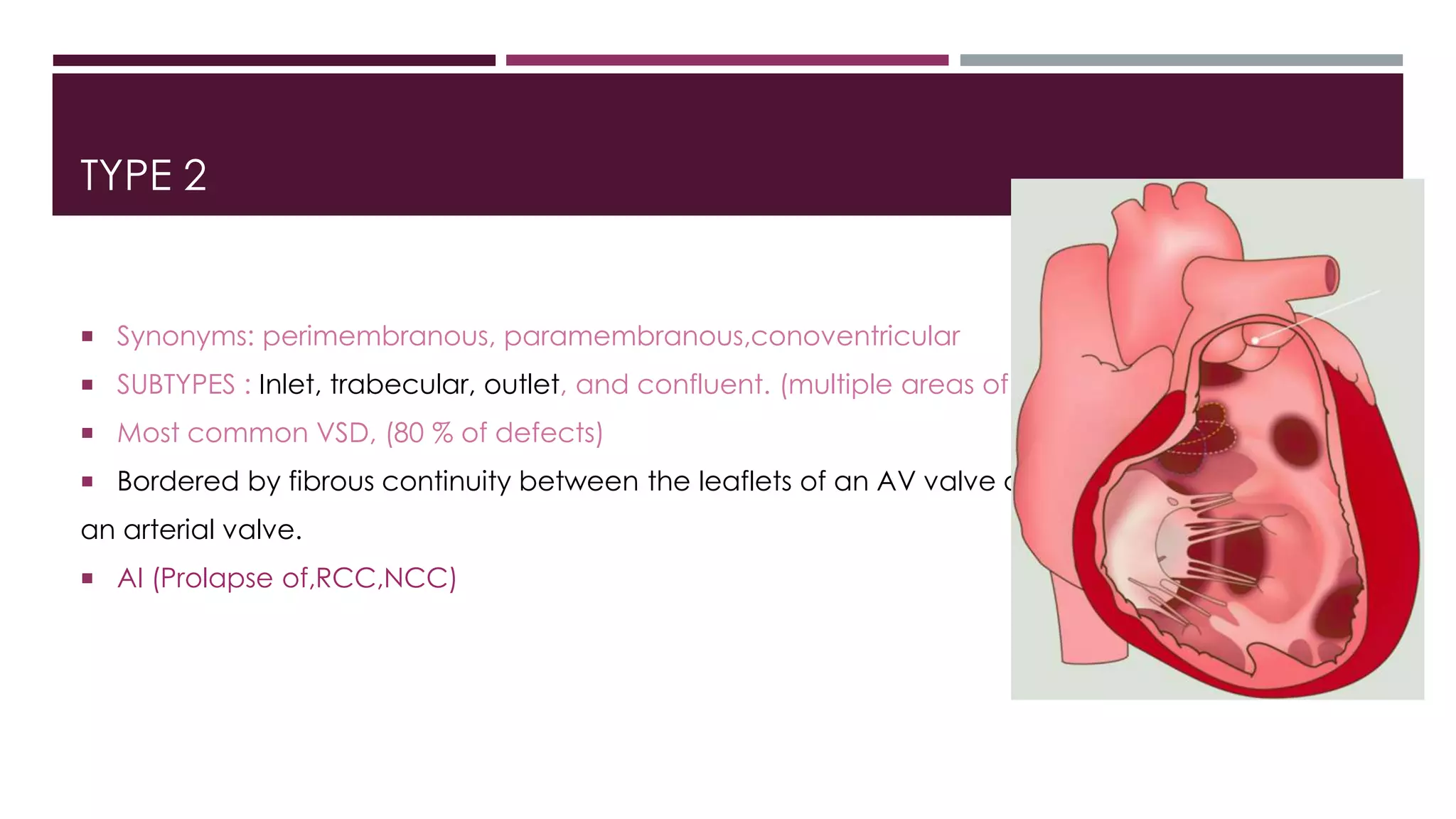 Ventricular septal defect, congenital heart disease | PPTX
