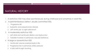 Ventricular septal defect, congenital heart disease | PPTX