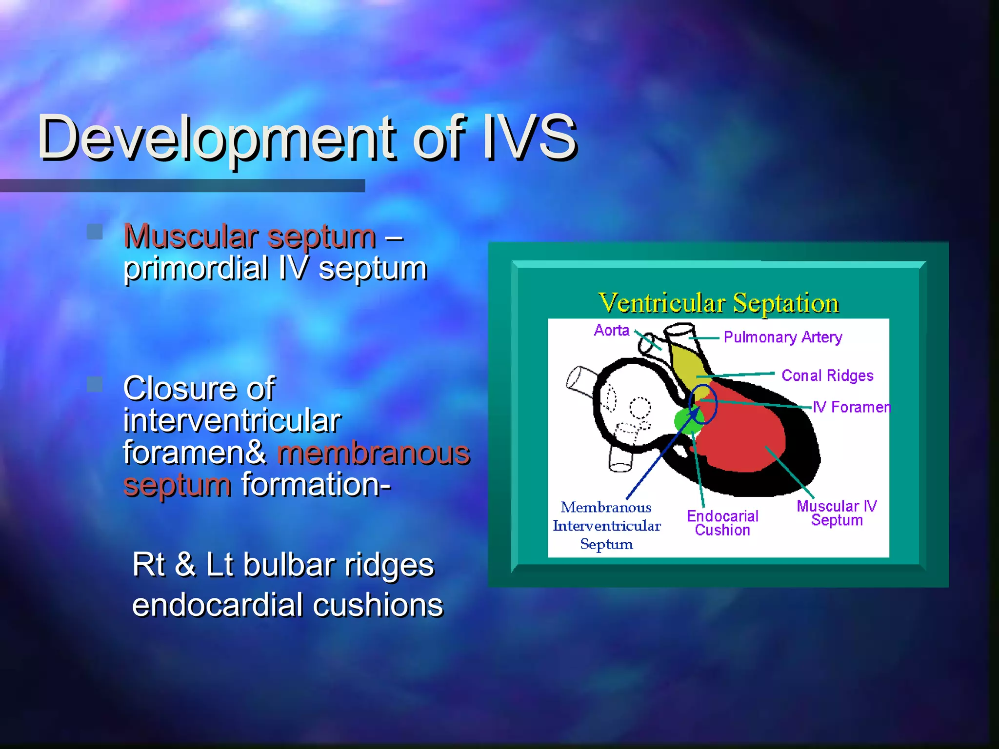 VENTRICULAR SEPTAL DEFECT | PPT