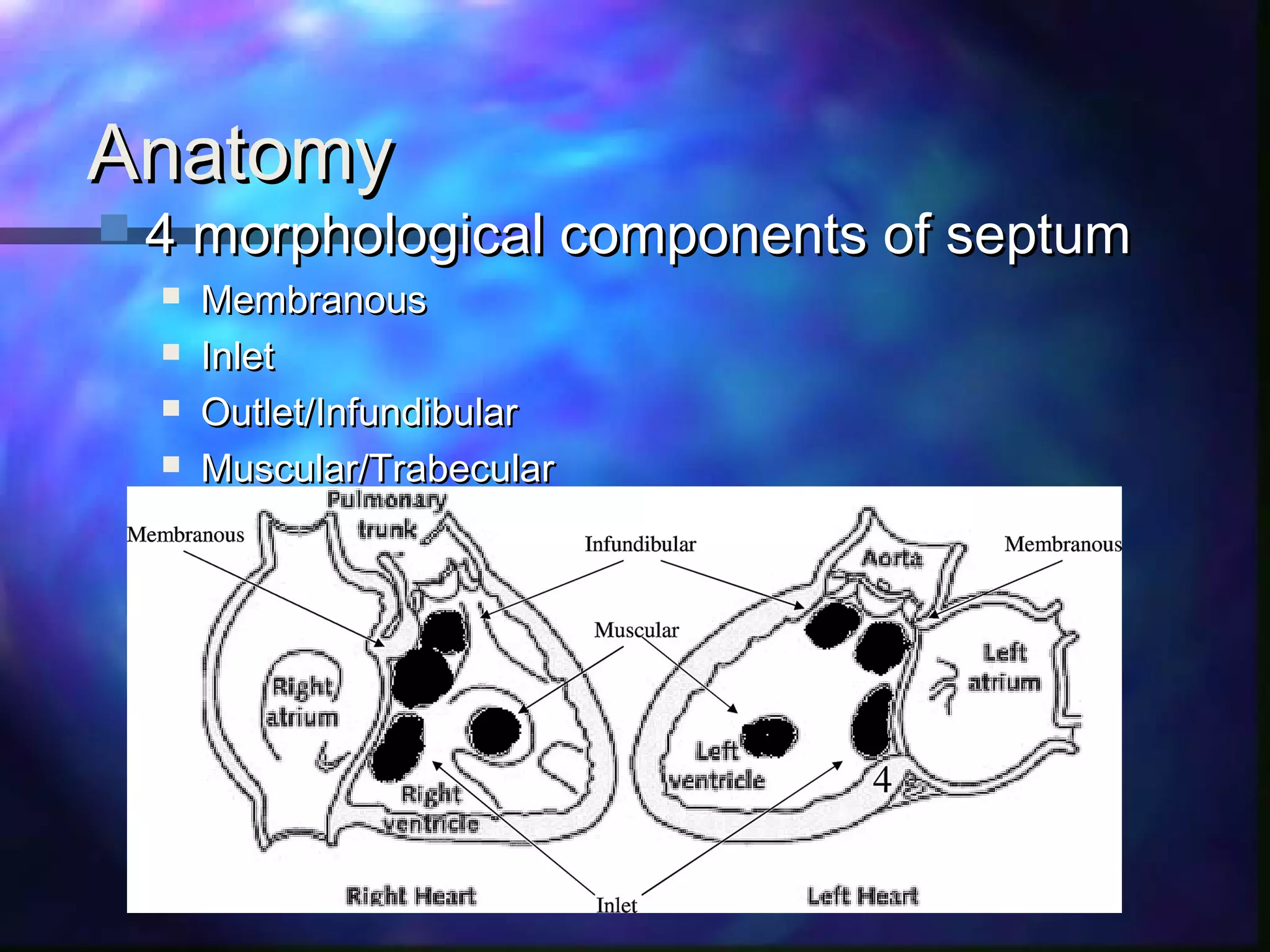 VENTRICULAR SEPTAL DEFECT | PPT