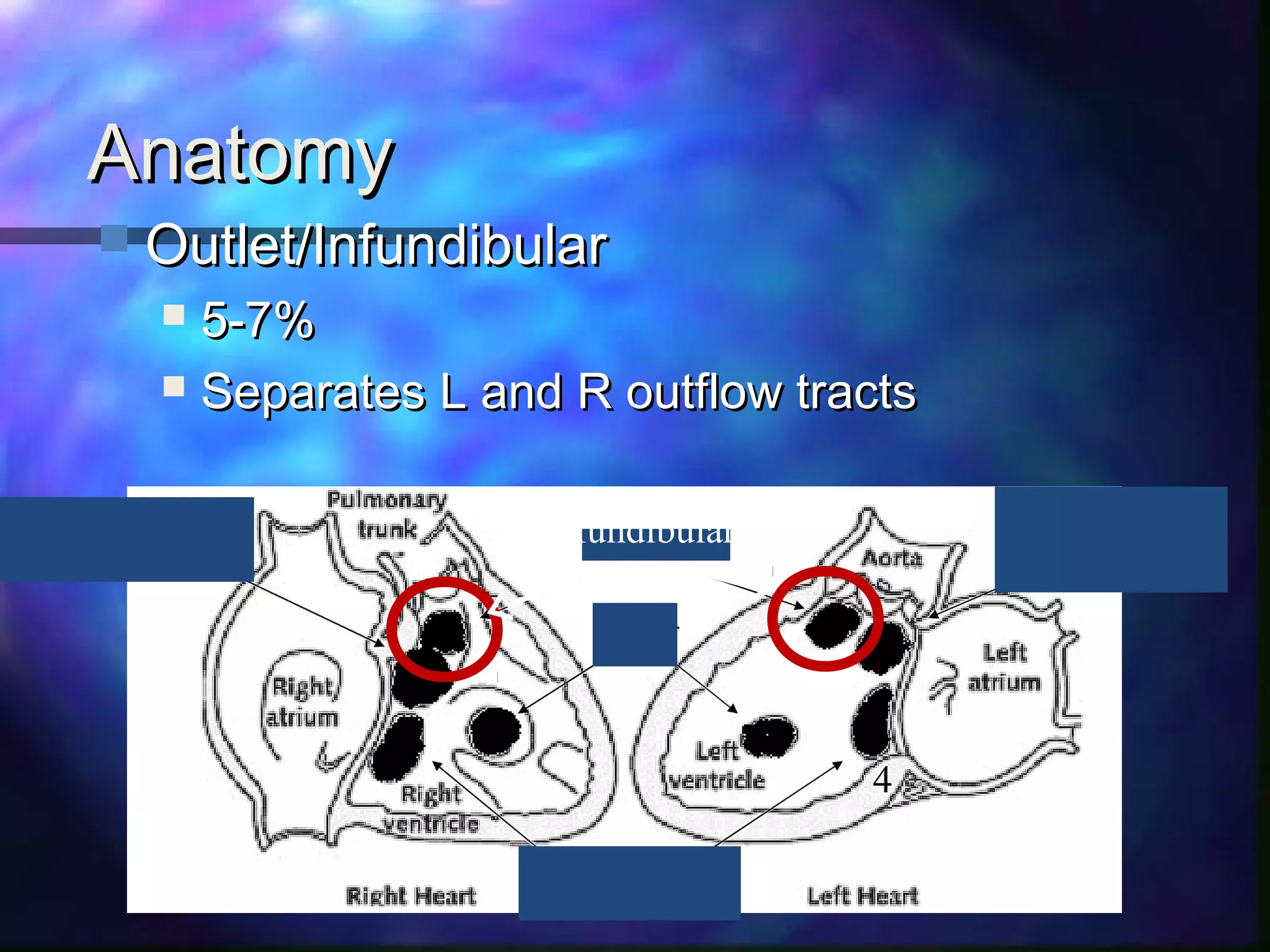 VENTRICULAR SEPTAL DEFECT | PPT