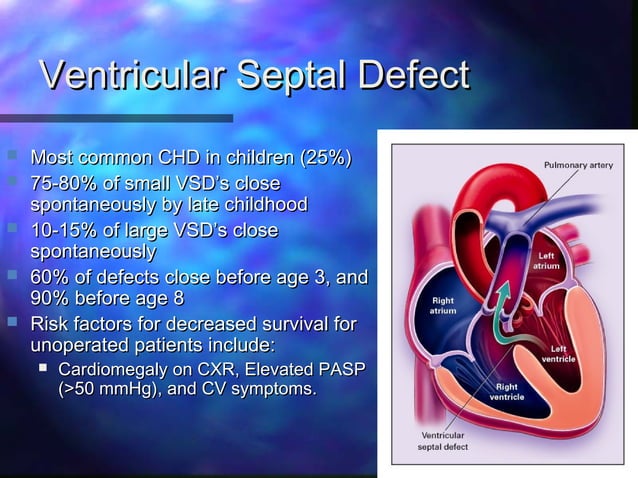 VENTRICULAR SEPTAL DEFECT | PPT | Heart and Cardiovascular Diseases ...