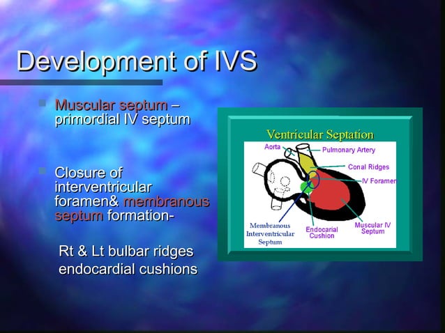 VENTRICULAR SEPTAL DEFECT | PPT | Heart and Cardiovascular Diseases | Diseases and Conditions