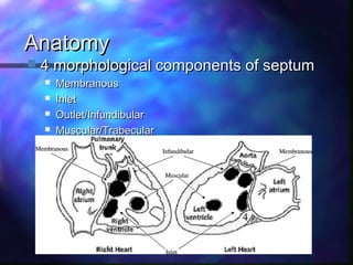 VENTRICULAR SEPTAL DEFECT | PPT