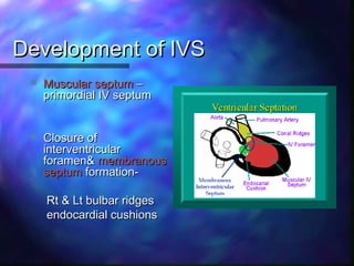 VENTRICULAR SEPTAL DEFECT | PPT