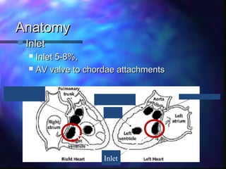 VENTRICULAR SEPTAL DEFECT | PPT