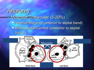 VENTRICULAR SEPTAL DEFECT | PPT