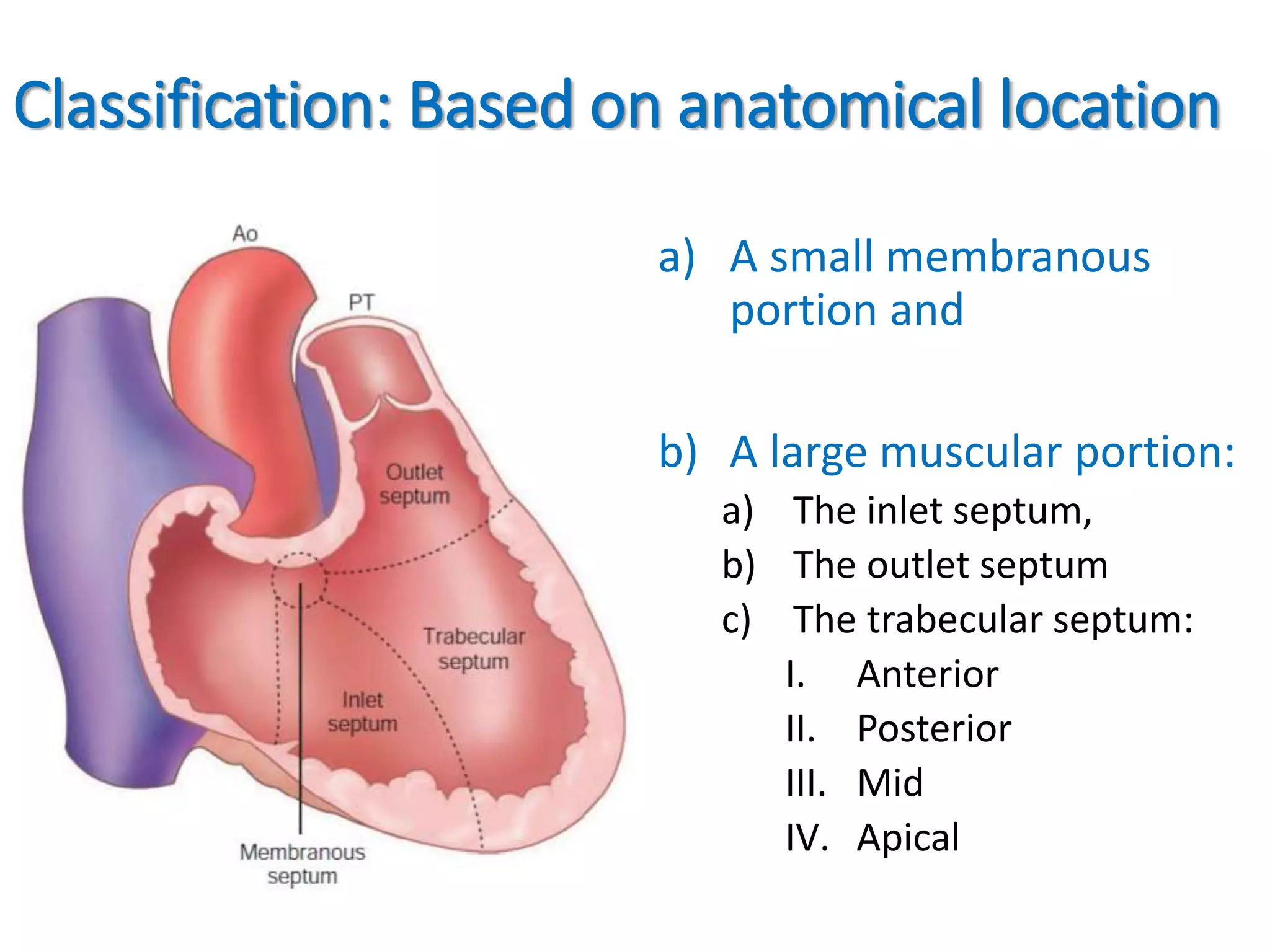 Ventricular Septal Defect | PPTX