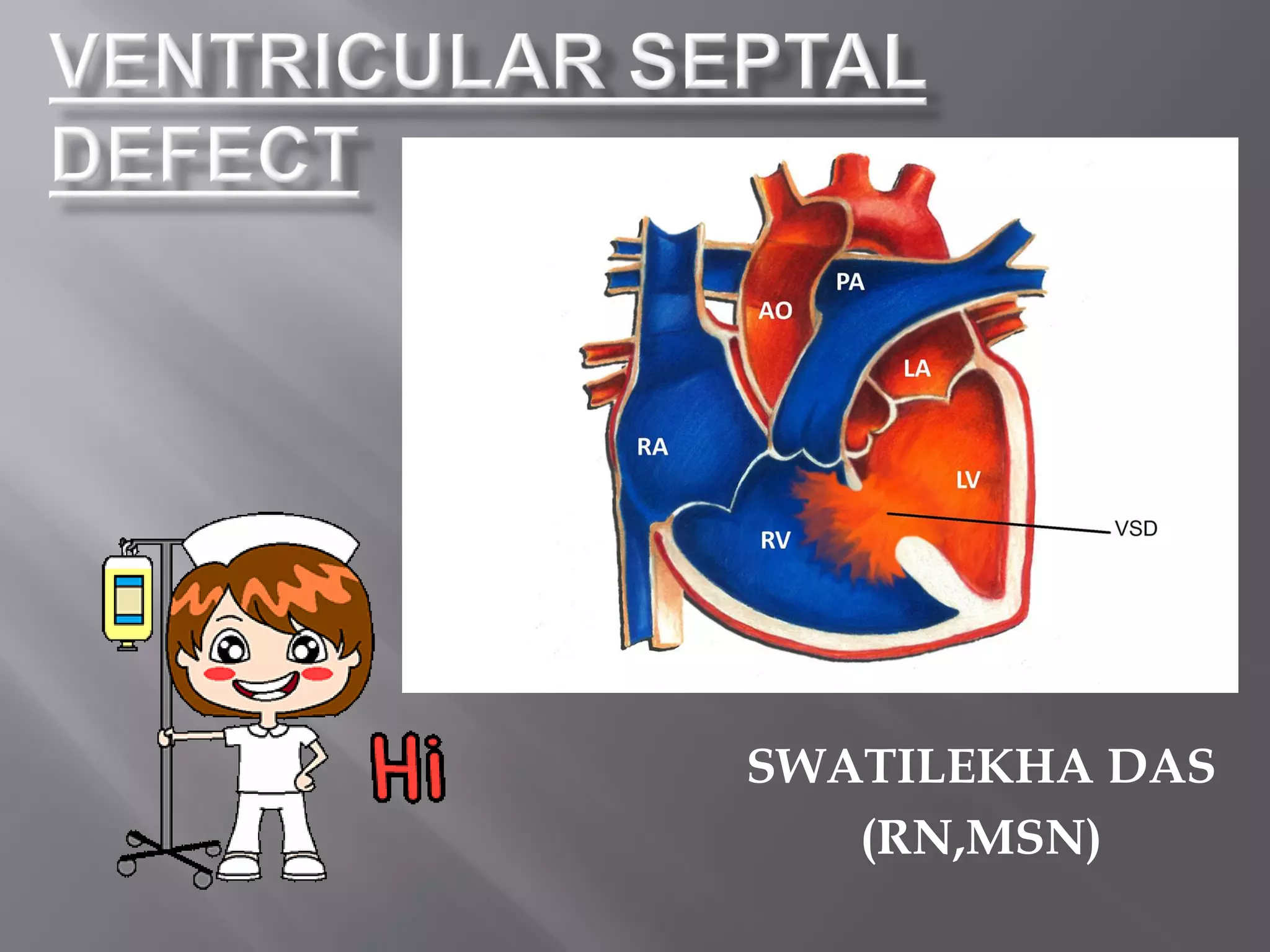 Ventricular Septal Defect with Nursing Management | PDF