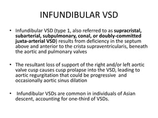 Ventricular Septal defects Echocardiography | PPTX