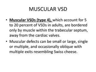 Ventricular Septal defects Echocardiography | PPTX
