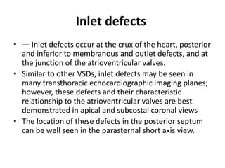 Ventricular Septal defects Echocardiography | PPTX