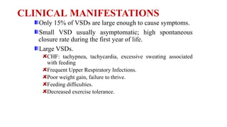 Ventricular septal defect in children.pptx