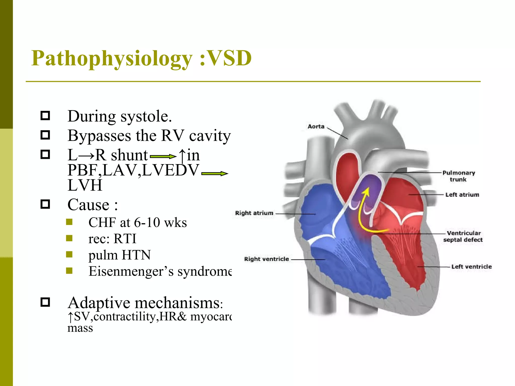 Vsd,Asd &Anaesthesia | PPT