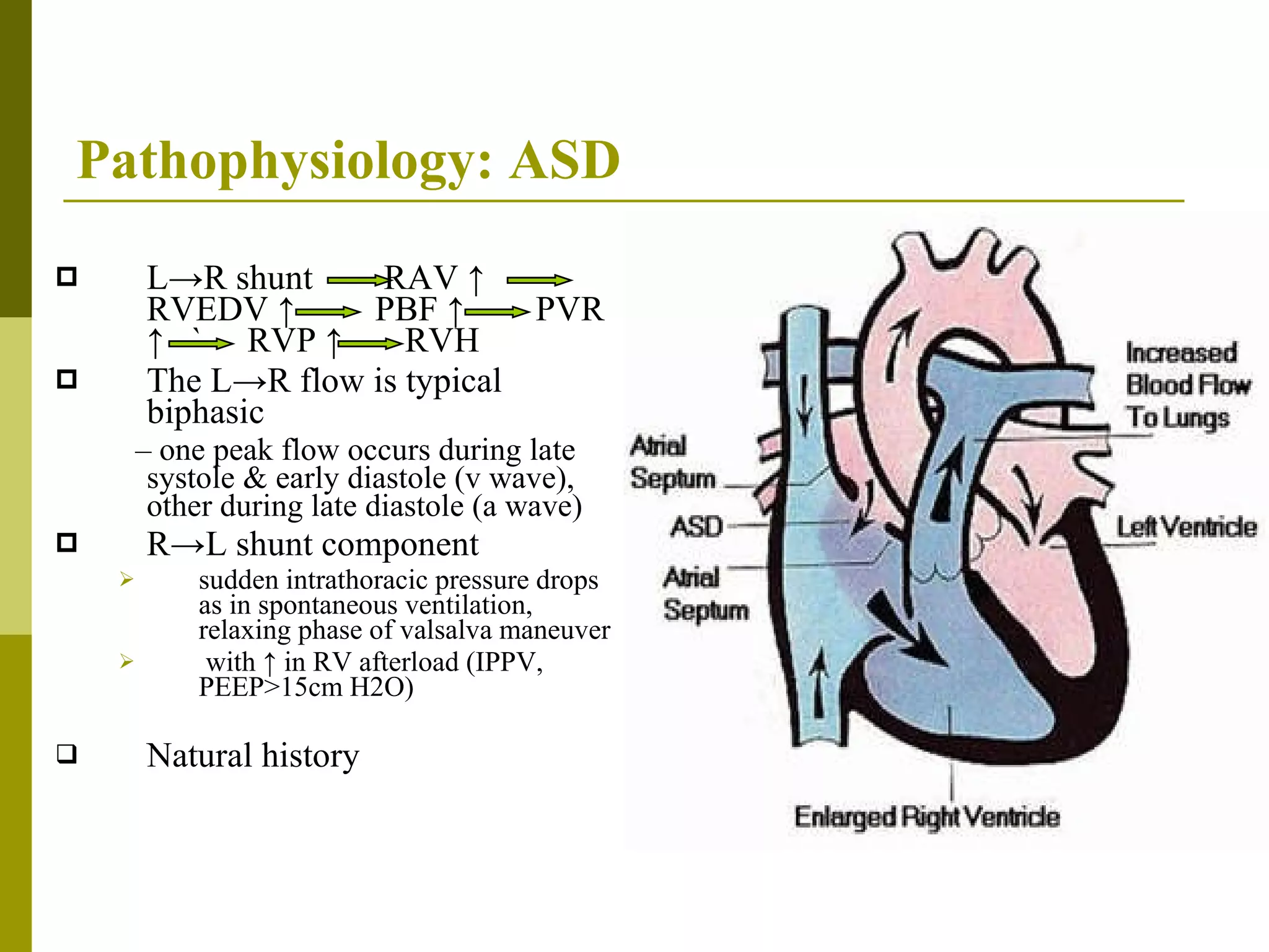 Vsd,Asd &Anaesthesia | PPT