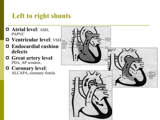Vsd,Asd &Anaesthesia | PPT