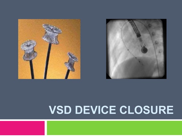 Vsd device closure | PPTX
