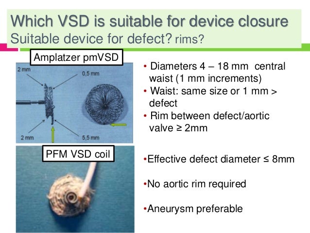Vsd device closure