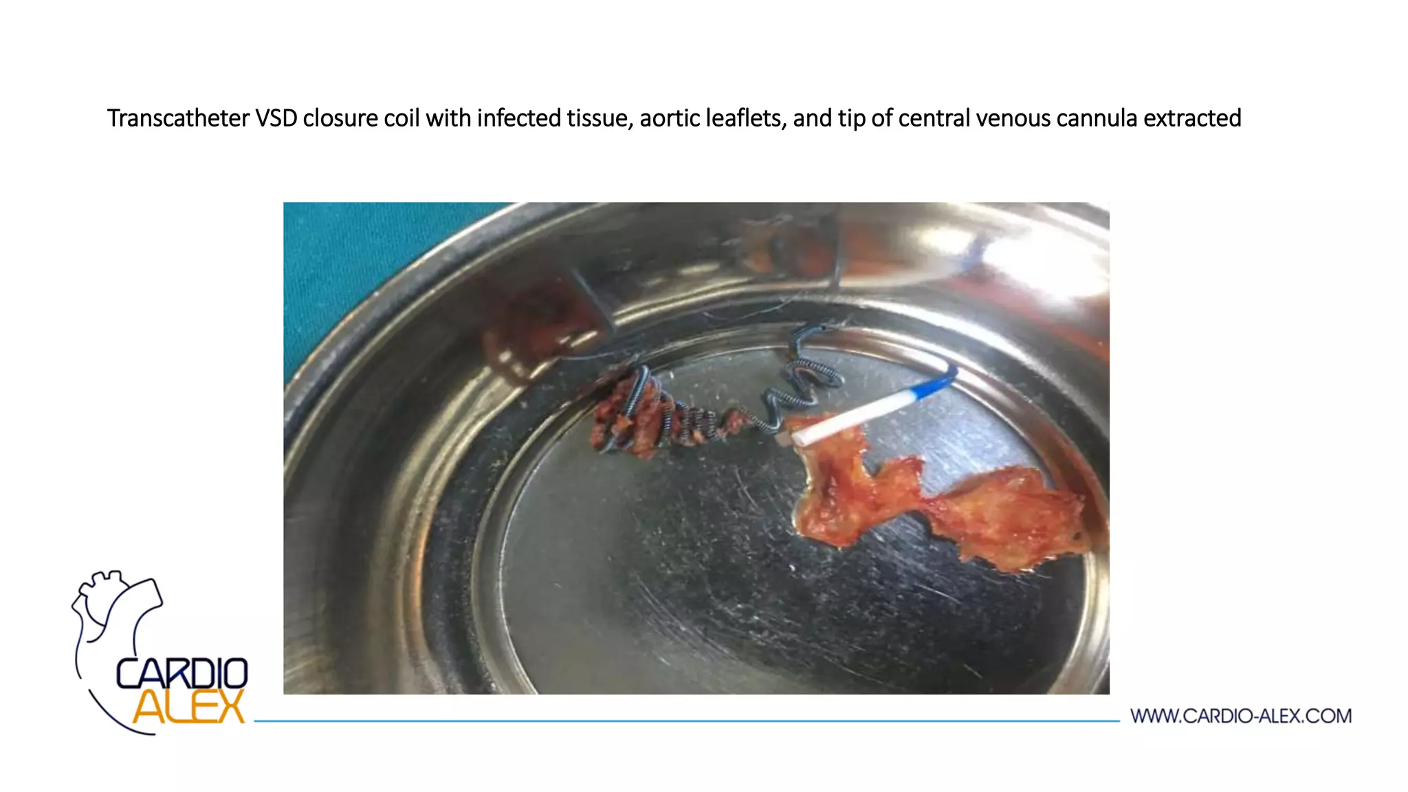 VSD device closure.pptx
