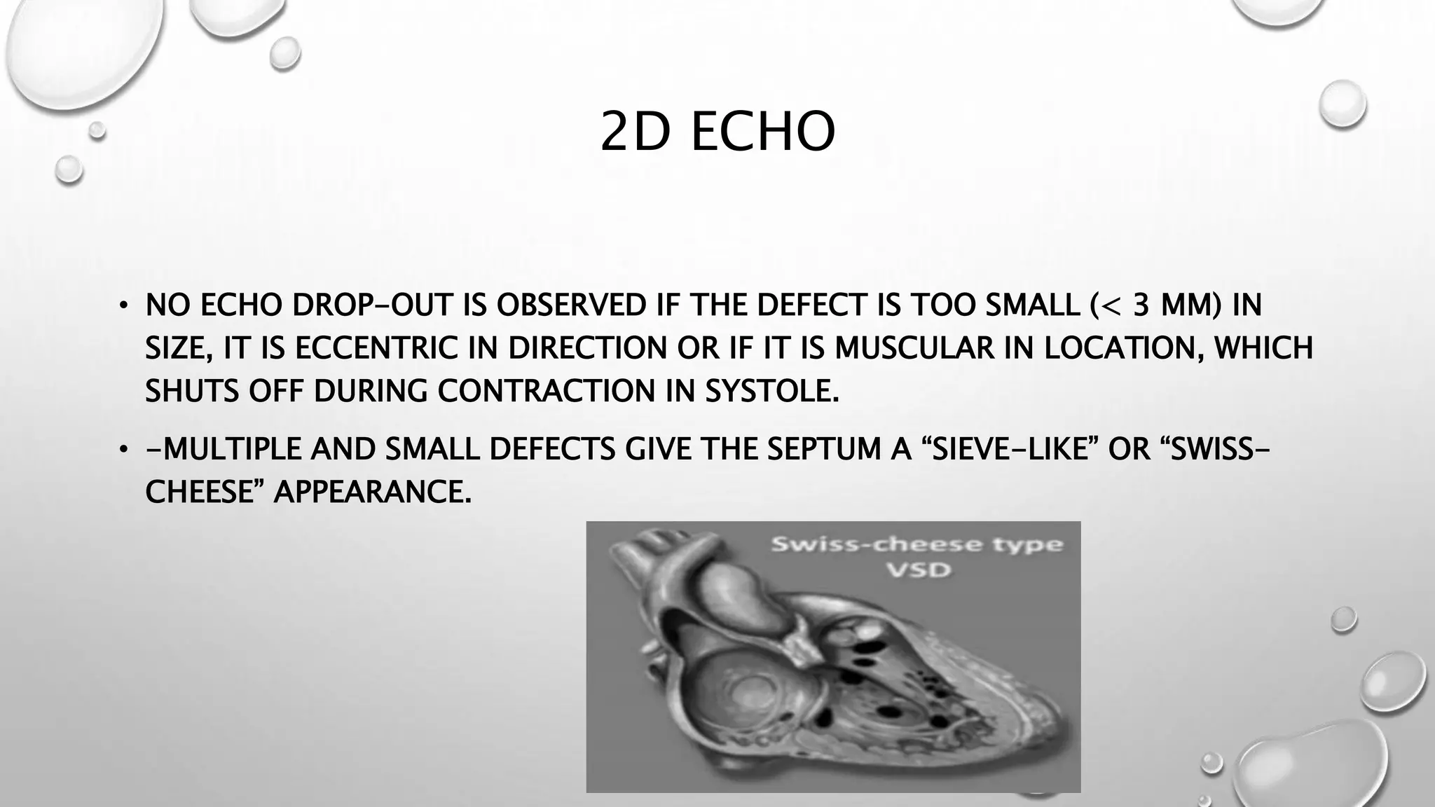 Vsd Echopptx