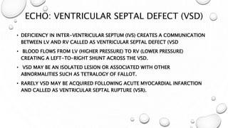 VSD ECHO.pptx