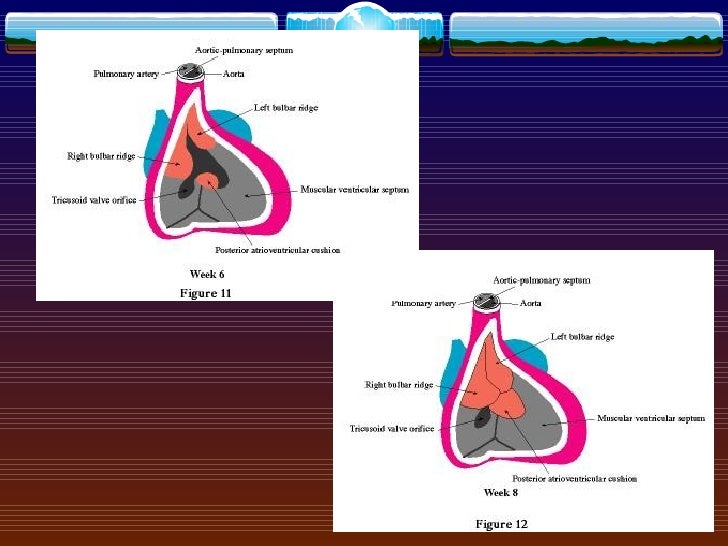 Vsd embryology