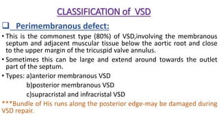 Ventricular Septal Defects | PPTX | Heart and Cardiovascular Diseases ...