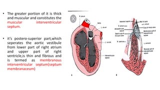 Ventricular Septal Defects | PPTX
