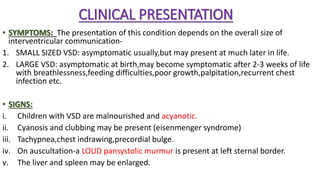 Ventricular Septal Defects | PPT