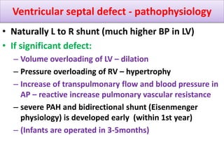An approach to a patient with ventricular septal defect | PPSX